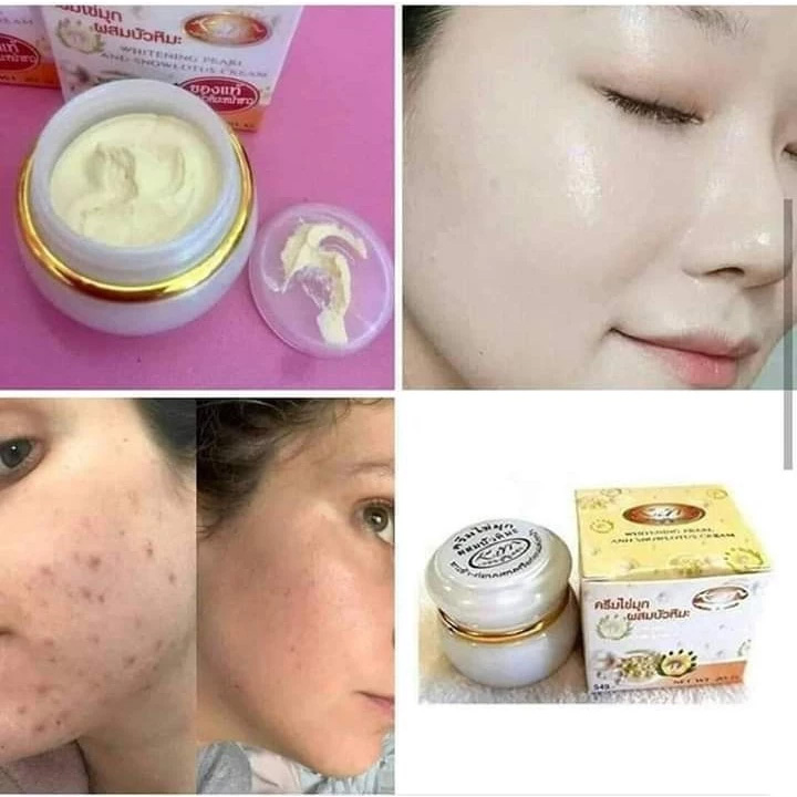 Kim Whitening Pearl And Snow Lotus Cream White 20g | Daraz.com.bd