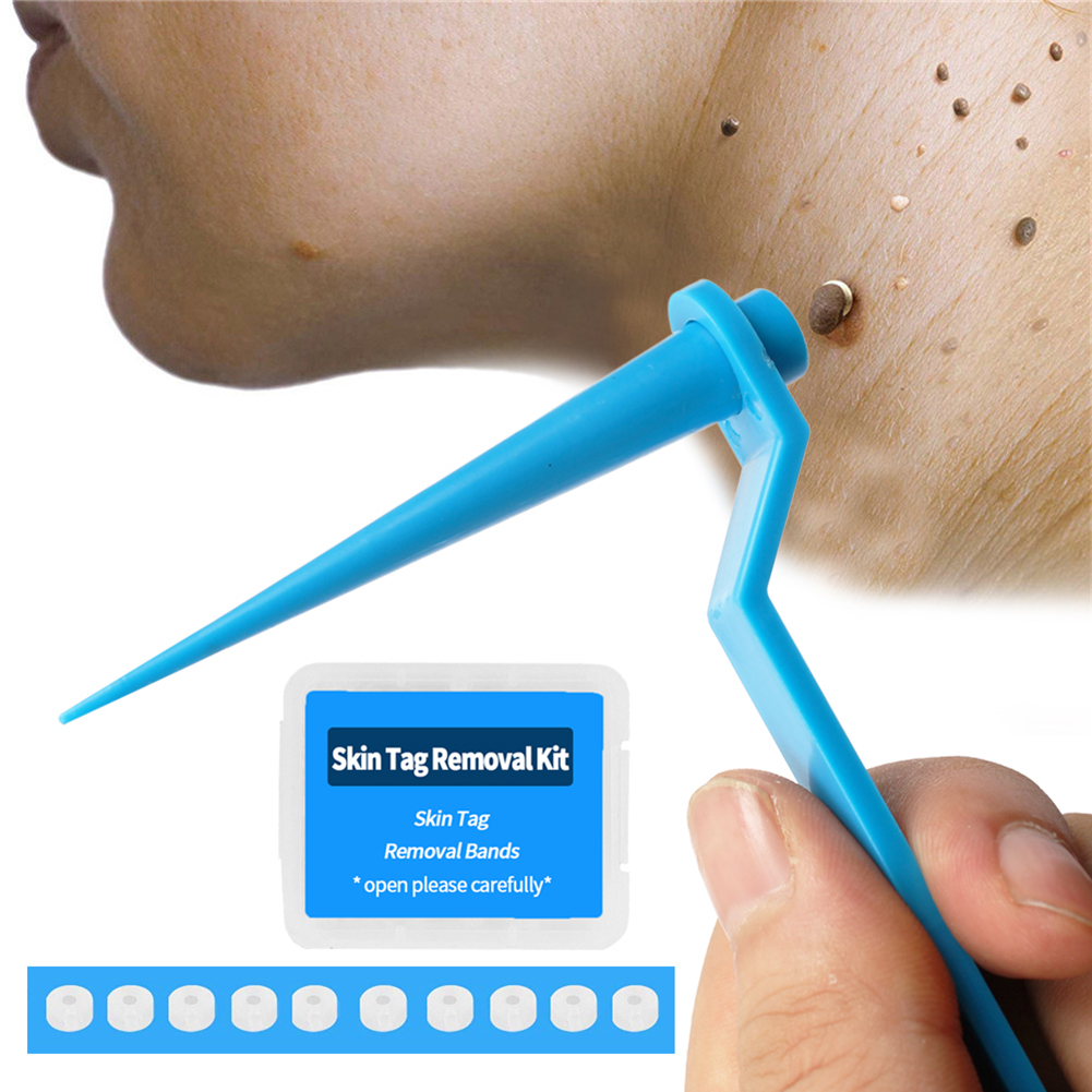 Skin Tag Remover Device for Large Mole Wart Removal with Removal Bands ...