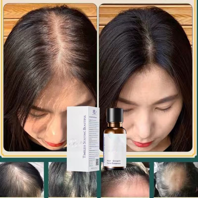 Hair Grower Fast Power Full Hair Growth Essence Hair Treament ...