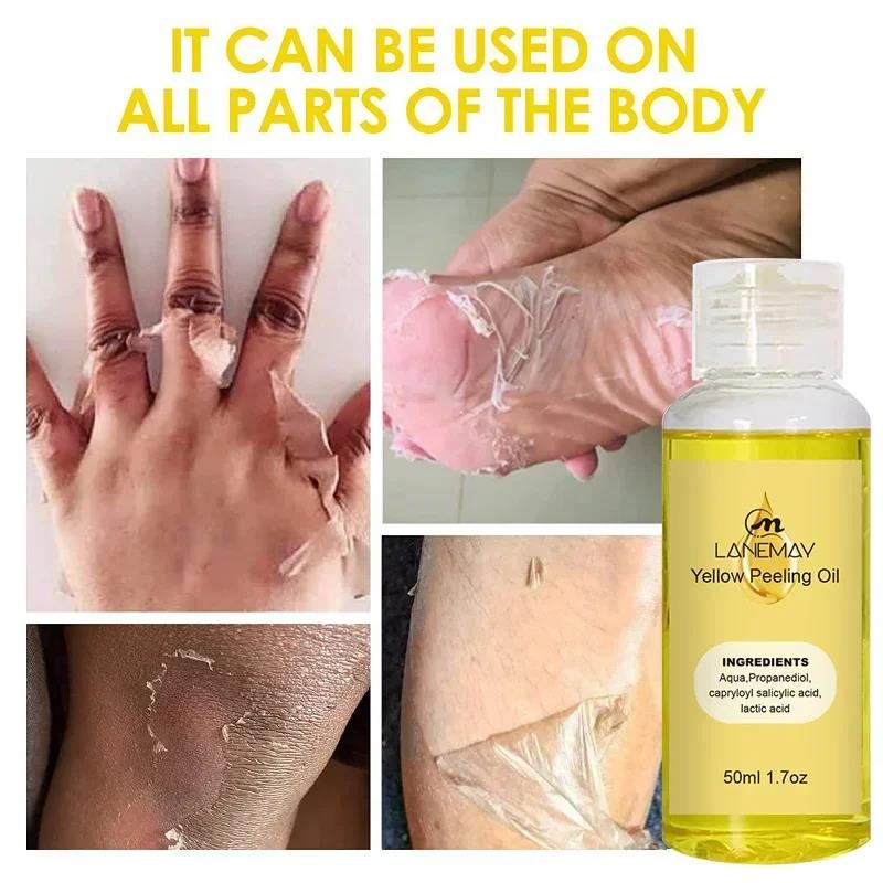 Yellow Peeling Oil Dark Skin Bleaching Remove Arm Knee Legs Melanin ...