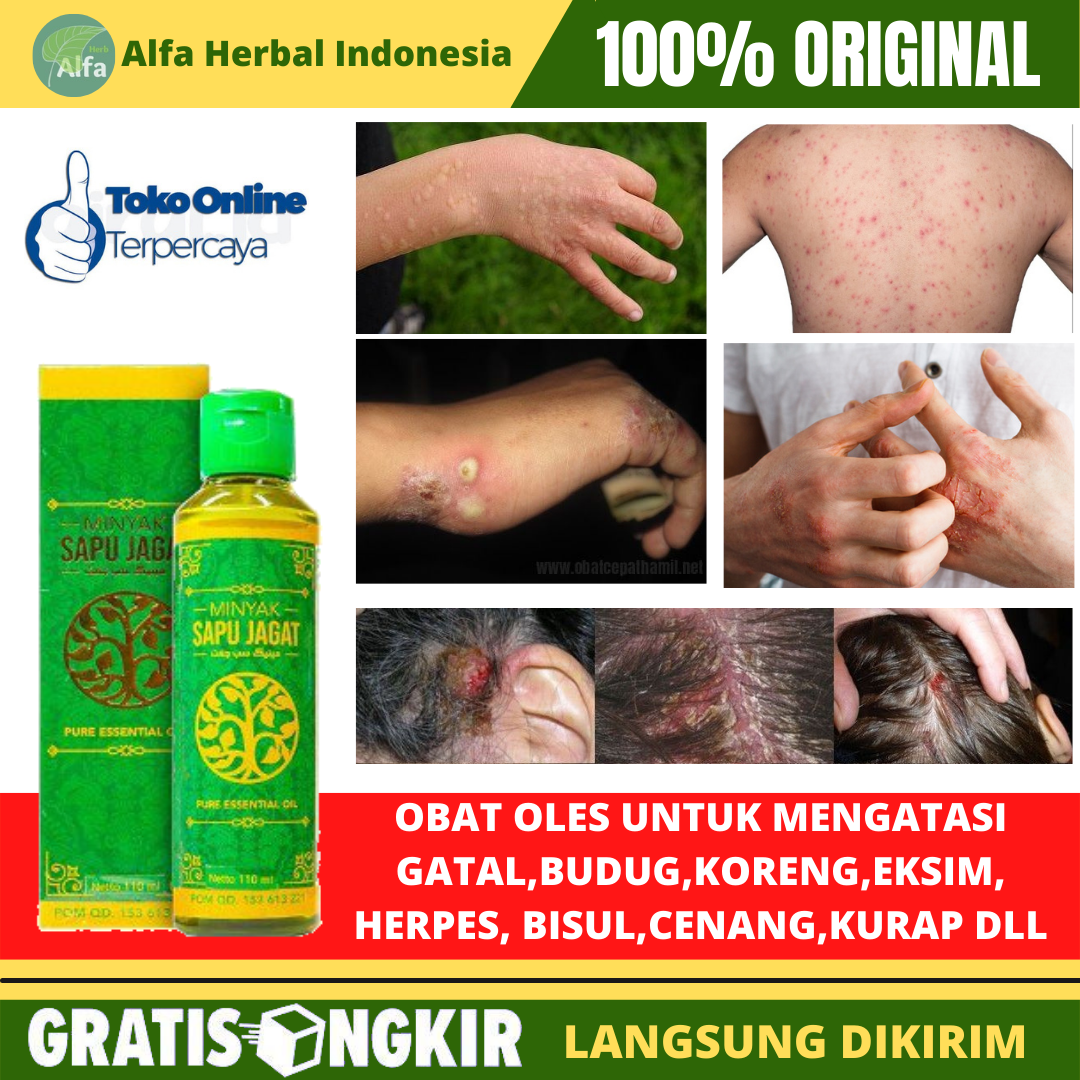 Obat Alergi Kulit Gatal Alami - Gatal Jamur Selangkangan Gatel2 Kulit ...