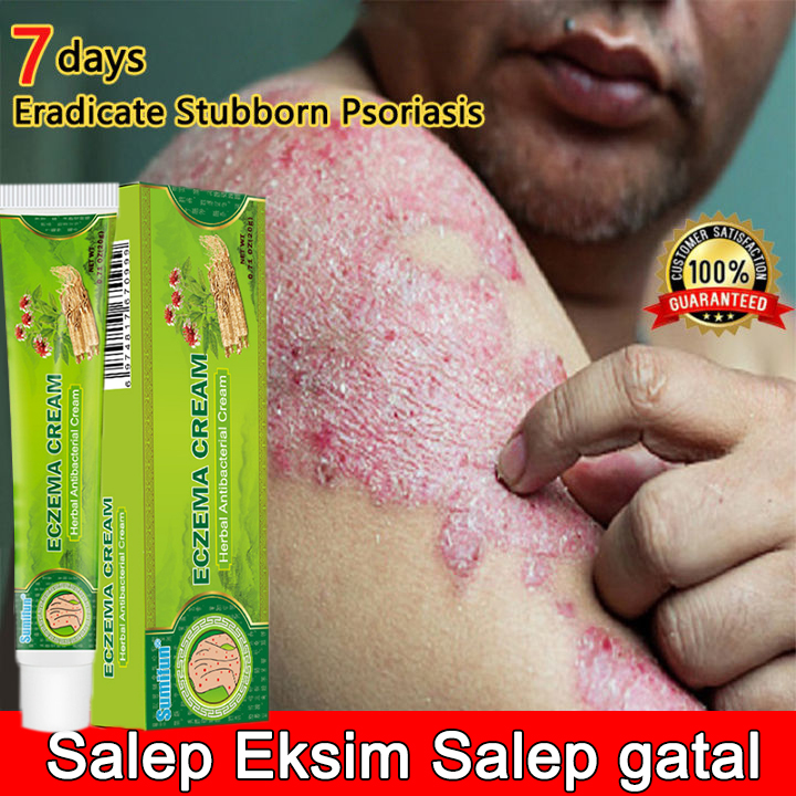 Salep Gatal 3 Seconds To Relieve Itching Eczema Ointment Cream ...