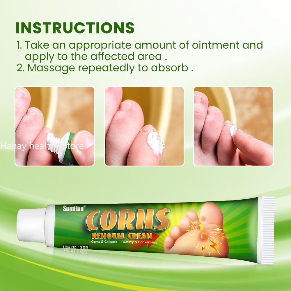 Foot Corn Remover Cream Chicken Eye Skin Infection Treatment Ointment ...