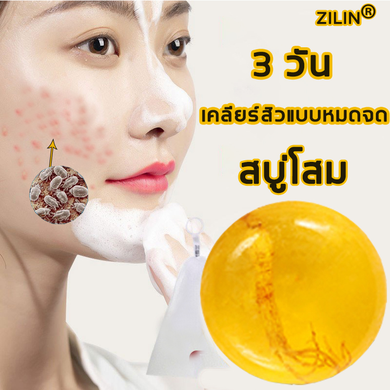 สบู่กำจัดสิว ZILIN สบู่ลดสิวหน้า 100g (สบู่ล้างหน้าใส สบู่ลดรอยสิว สบู่ ...