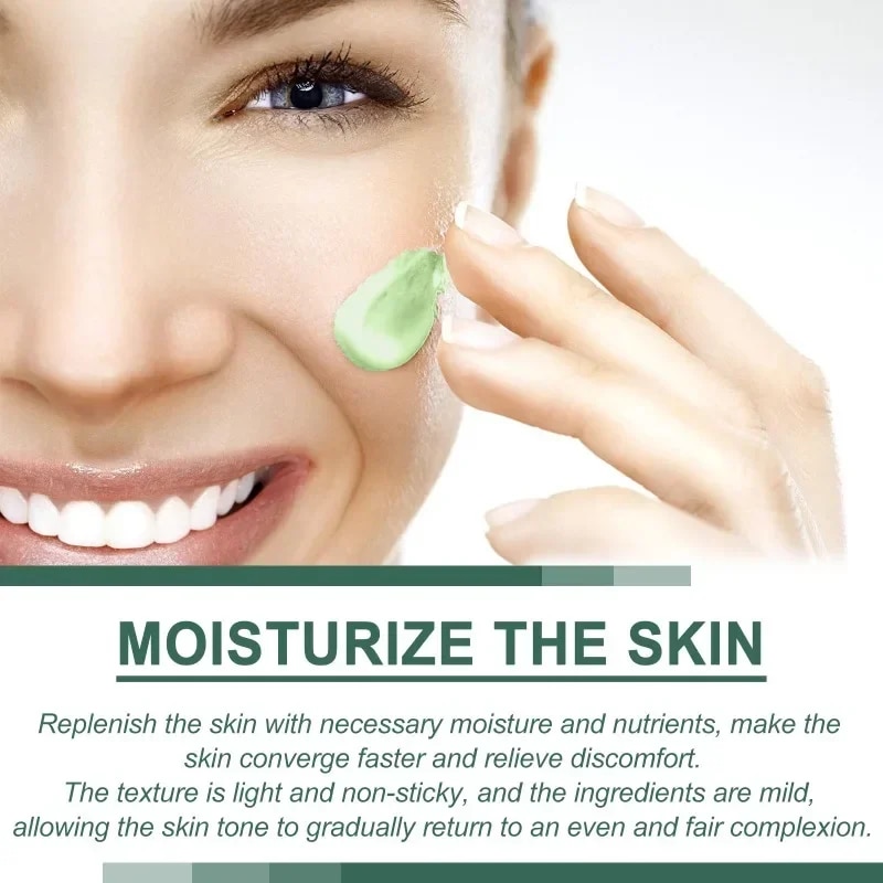 Anti freckle cream fade spots pimple improve dull Melanin remove Acne ...