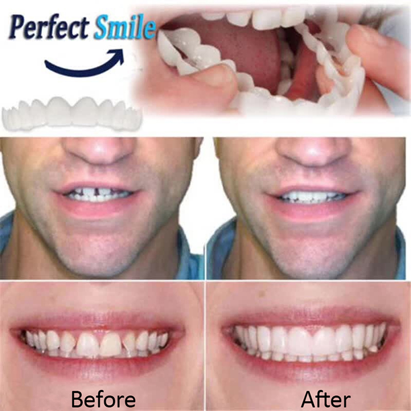 NEW 【Unique features】3PCS Denture Teeth Cover Comfort Fit Snap On ...