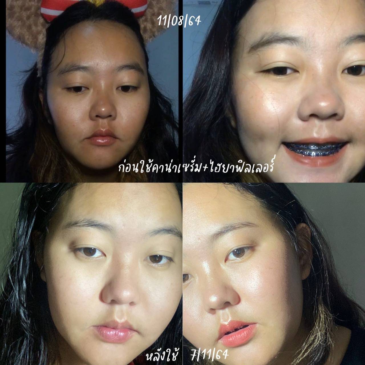 แท้ 100% เซรั่มไฮยา Haewon Hya Filler Anti Deep Wrinkle Enrich Serum ...