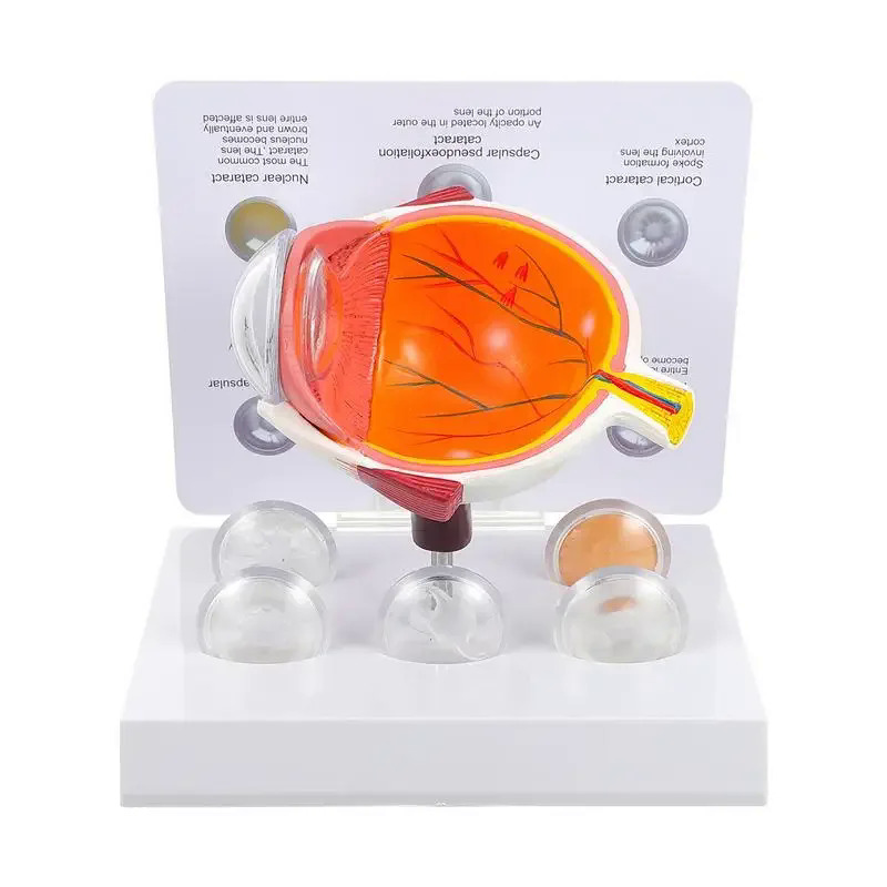 Cornea Eyeball Model Human Eye Model Human Eye Demonstration Teaching ...