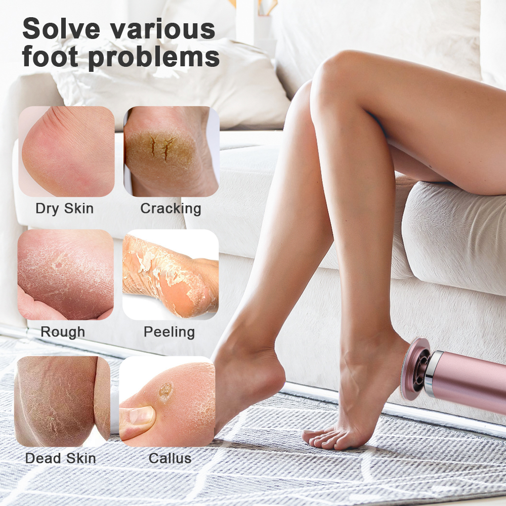 【Limited Time Only】 Electric Pedicure Tools Foot Care File Leg Heels ...